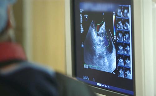 WATCHMAN Resources - Education Specialists, Guides, and Videos