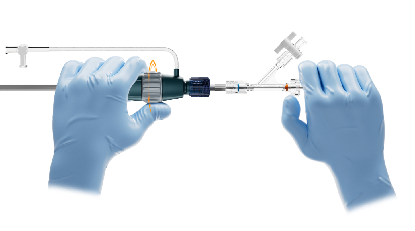 WATCHMAN TruSteer™ Access System