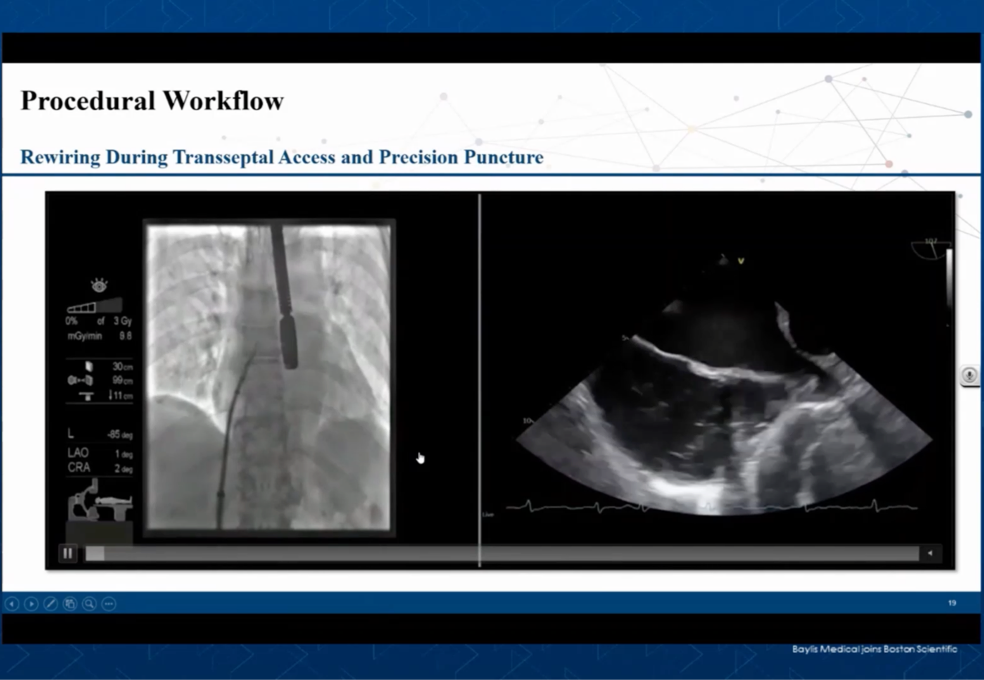 VersaCross Connect™