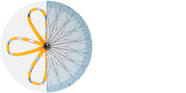 Concomitant AFib ablation and WATCHMAN Implant procedures