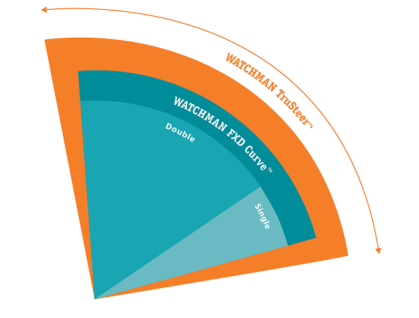 WATCHMAN FXD Curve Access System - Placement, Delivery - WATCHMAN FLX