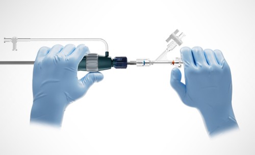 WATCHMAN TruSteer Access System - Deployment - WATCHMAN FLX