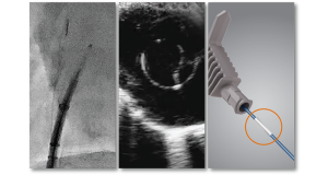 VersaCross Connect LAAC Access Solution - WATCHMAN FLX